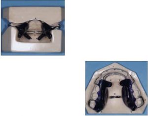 Biobloc Orthotropics | Orthotropic Treatment for Adults